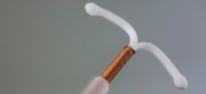 Woman had two contraceptive coils fitted at the same time - M R Law ...